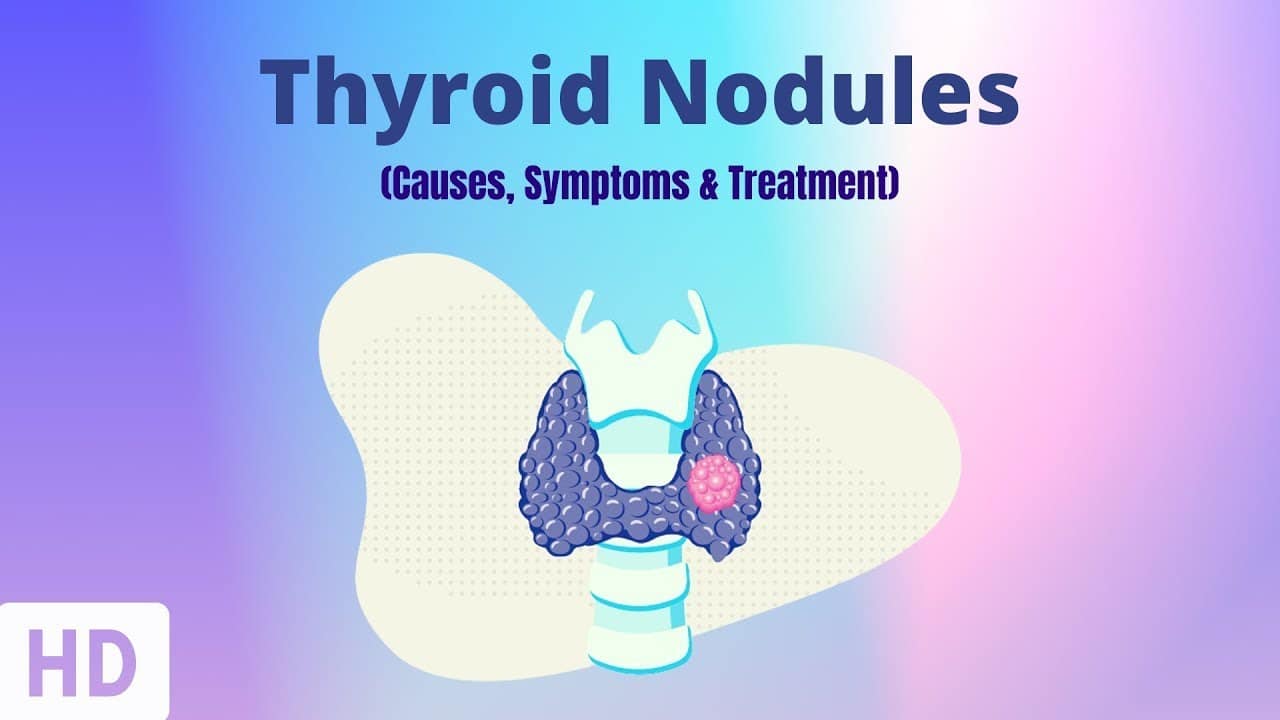 Thyroid Nodules Symptoms: Is That Lump in Your Neck Just a Fashion ...